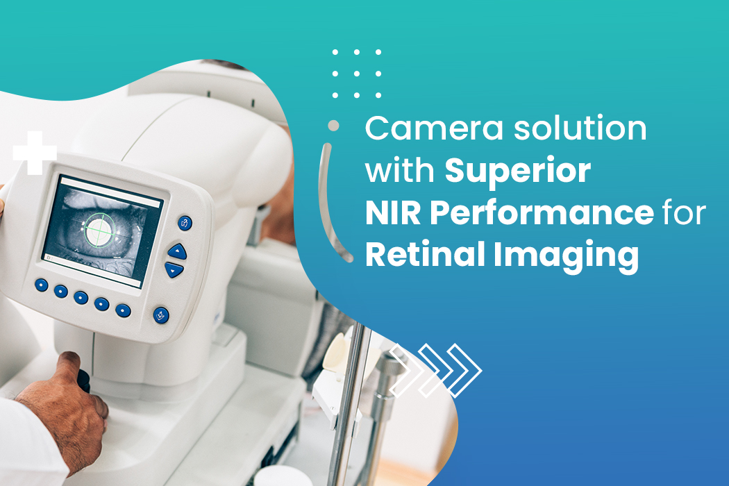 Camera solution with superior NIR performance for retinal imaging - e ...