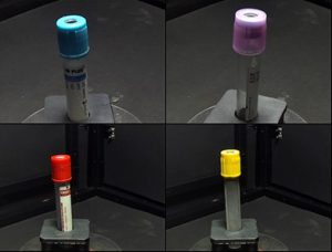 Overcome the challenges of classifying blood collection tubes using AI ...