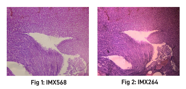 e-con Systems expands Medical Camera Series with addition of 5MP SONY ...