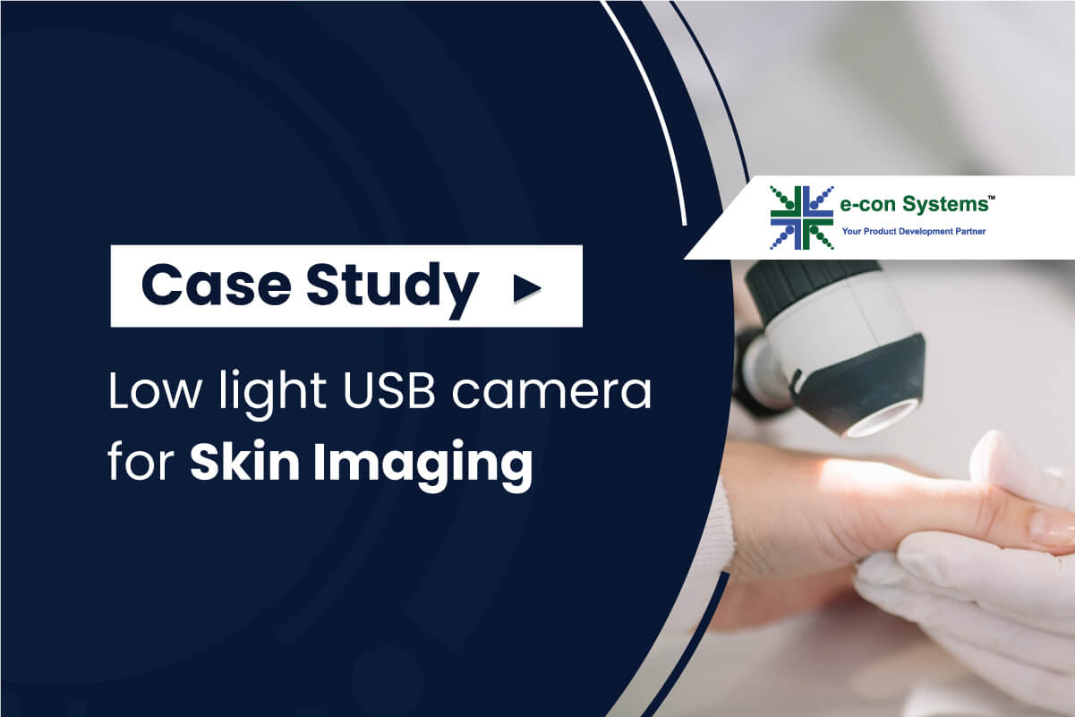 Dermatology Cameras Case Study